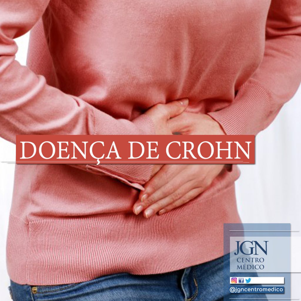 Doença de Crohn – JGN